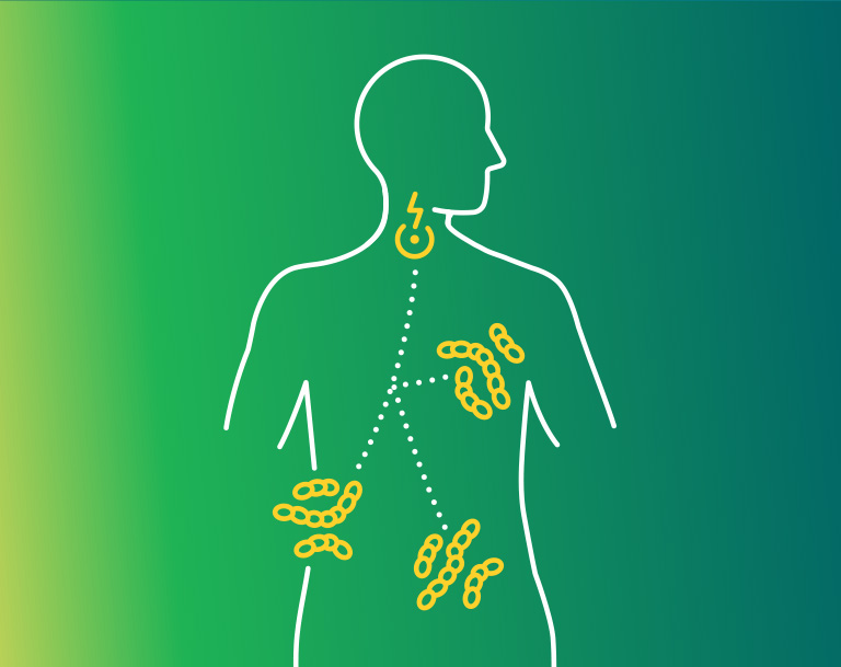 Strep Throat Rapid Tests, Symptoms & Treatment | Abbott Point of Care