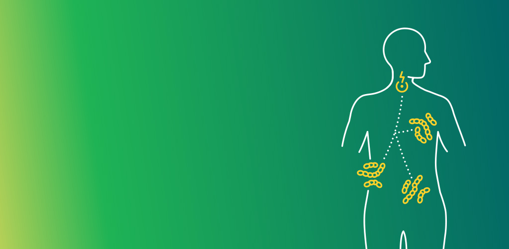 Strep Throat Rapid Tests, Symptoms & Treatment | Abbott Point of Care